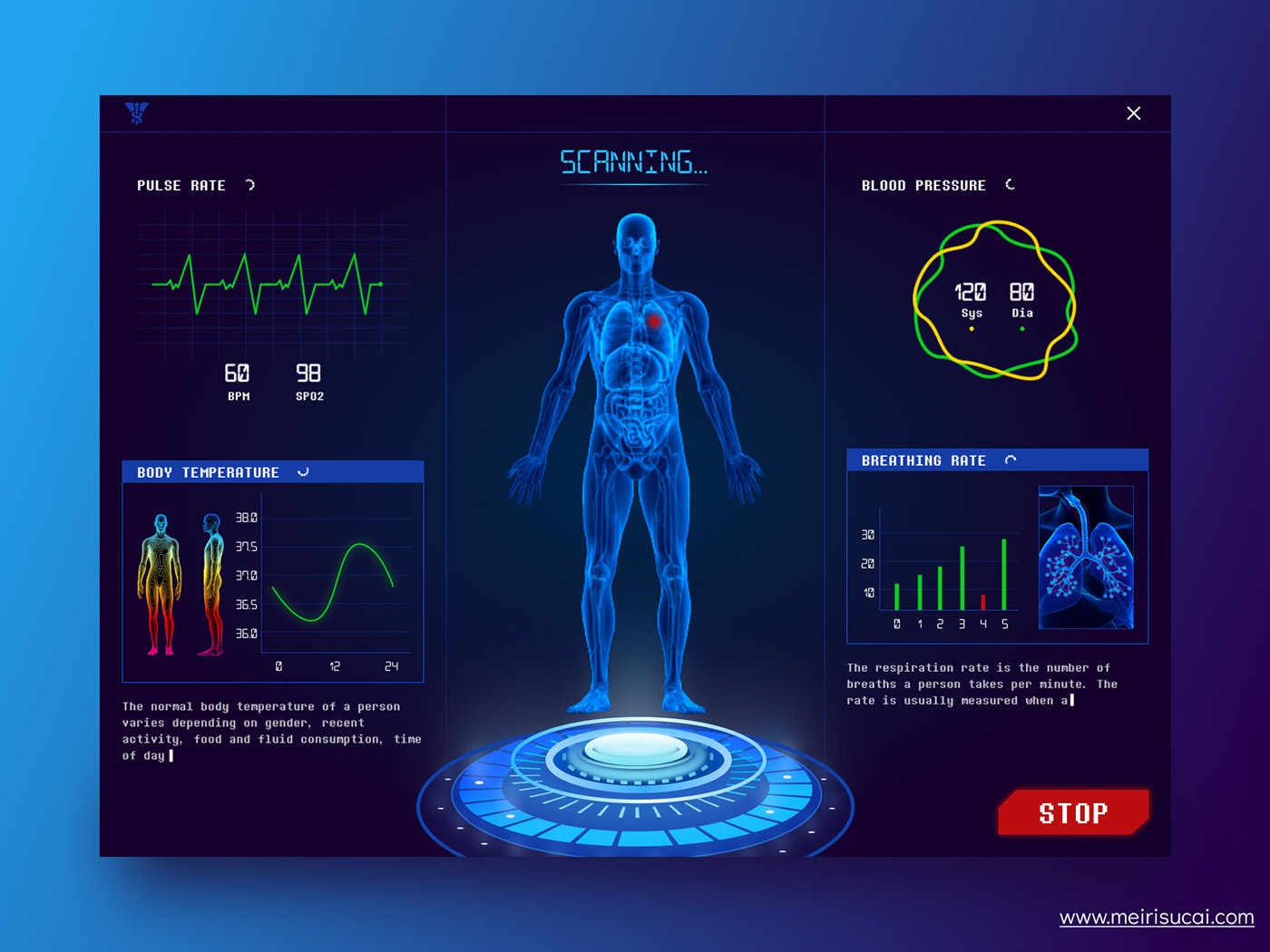 健康扫描系统figma素材